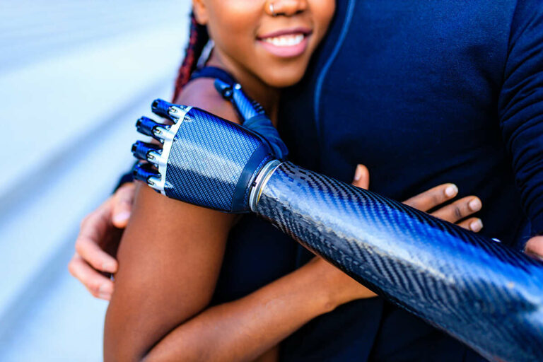 How Do Bionic Arms Work: A Look at the Science and Innovation