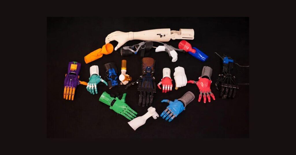 Transforming Lives with 3D Printed Prosthetics