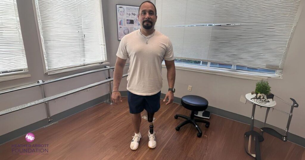 How to Get a Prosthetic Leg for Free (Step-by-Step Guide)