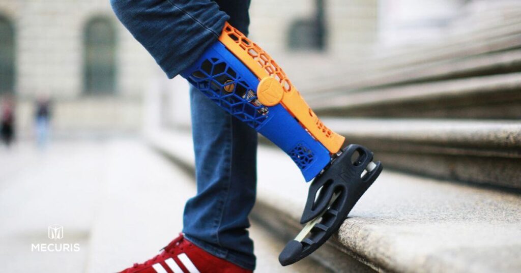 Top 8 3D Printing Prosthetics Companies - Is Brave