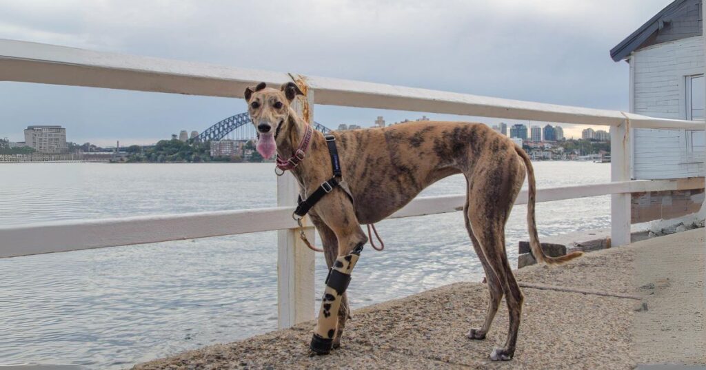 Transforming Lives with 3D Printed Prosthetics