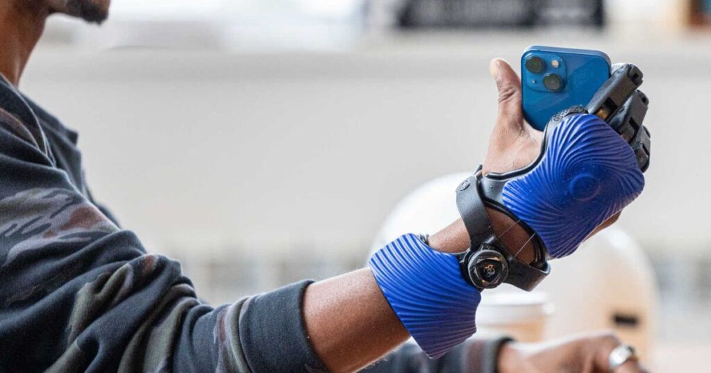 Best Finger Prosthetics: 5 Types and Real Options Compared - Is Brave