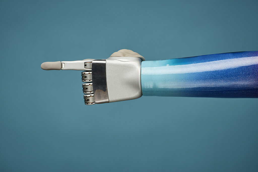 Advancements in Prosthetics with a Sense of Touch (2025)