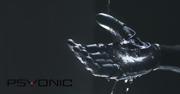 Advancements in Prosthetics with a Sense of Touch (2025)