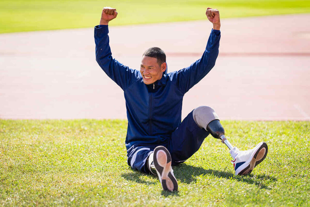 Everything You Need to Know About Below Knee Prosthetic Leg