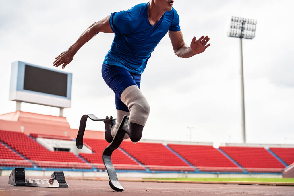 Can You Do Everything with a Prosthetic Leg: Stay Active Now