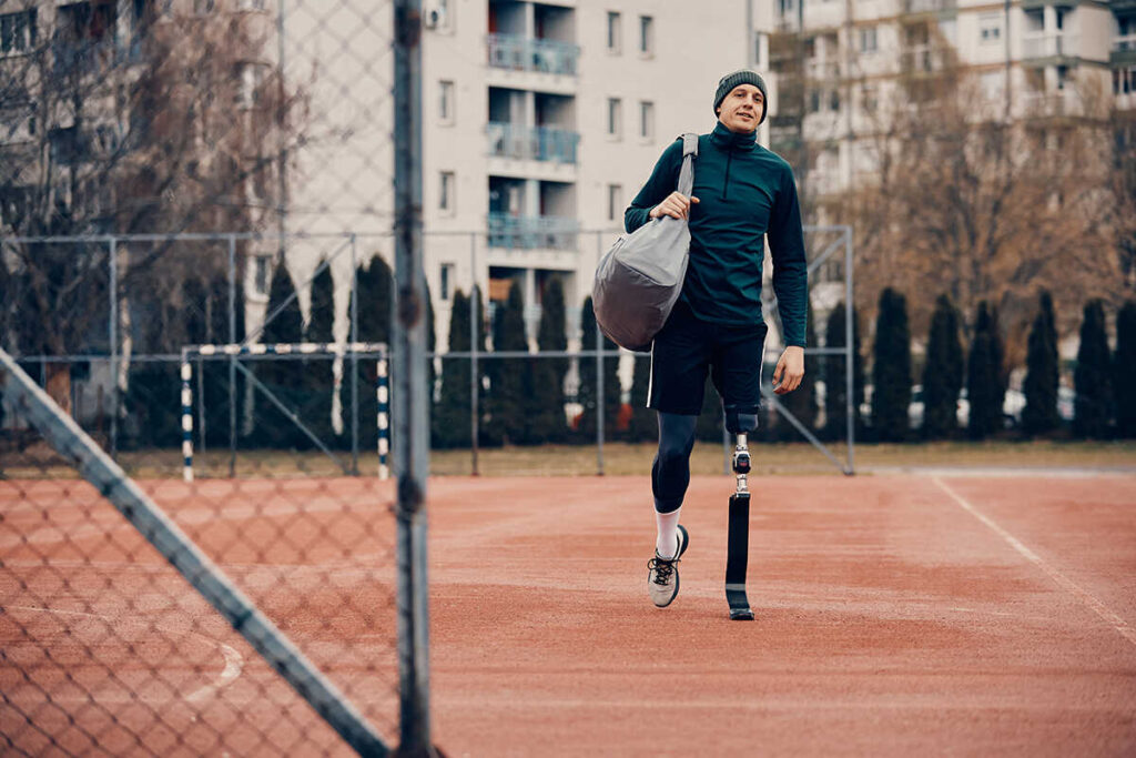 Prosthetic Leg Above-Knee: What You Need to Know