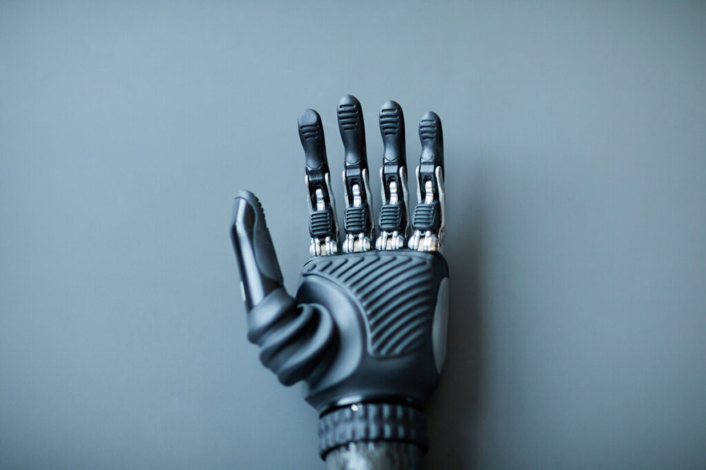 Robotic Finger Prosthetics: Everything You Need to Know