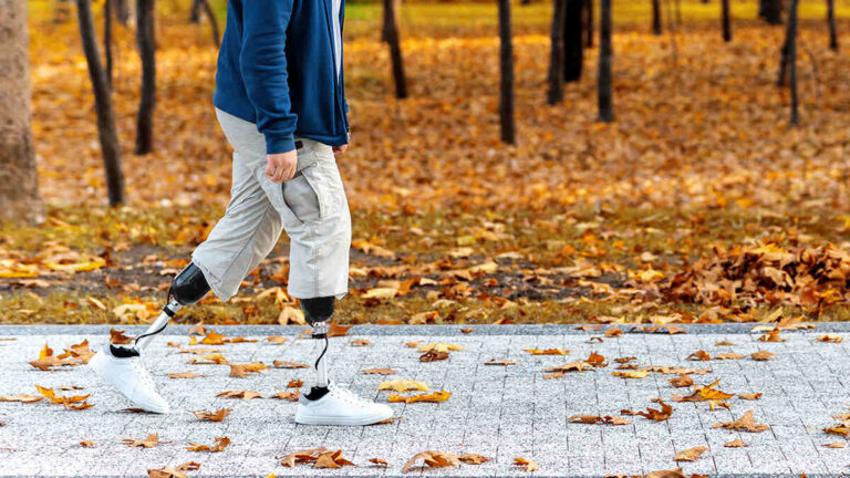Everything You Need to Know About Below Knee Prosthetic Leg