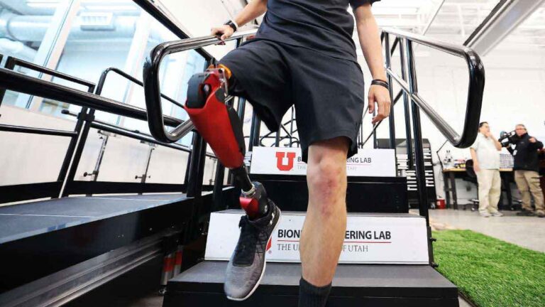 The Rise of Bionic Leg: Smart Prosthetics for Amputees (2025)