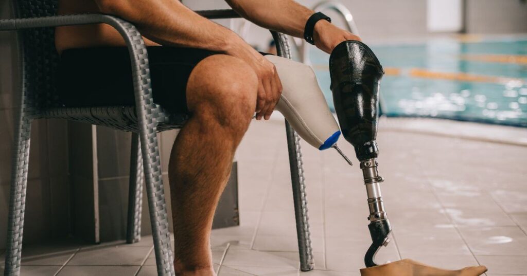 Common Problems with Prosthetics and How to Handle Them