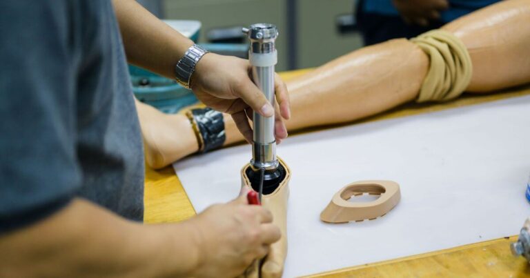Everything You Need to Know About Prosthetic Leg
