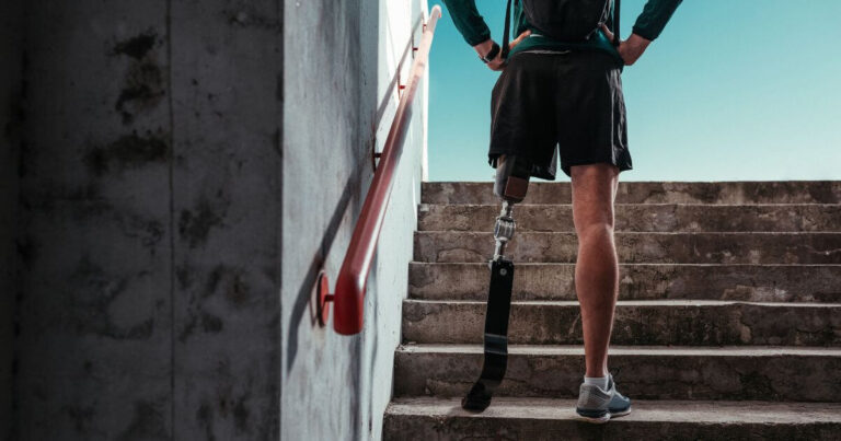 Common Problems with Prosthetics and How to Handle Them