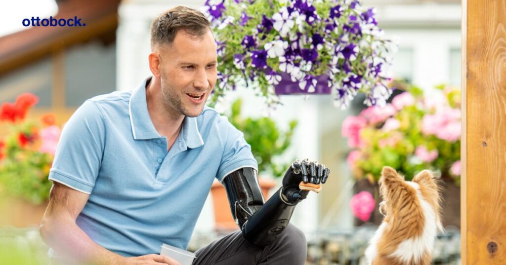 How Do Bionic Arms Work: Simple Guide + Top Models Today - Is Brave