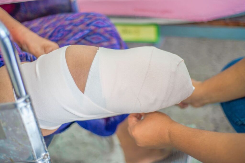 Residual Limb Care: Essential Tips for Skin Health and Comfort