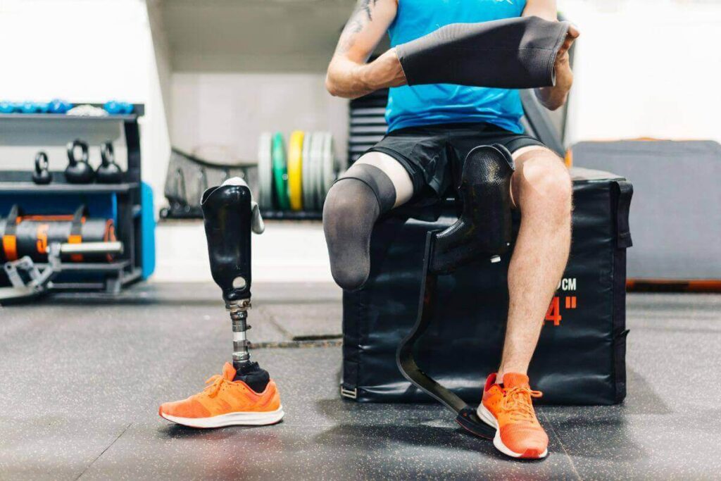 Prosthetic Leg Above-Knee: What You Need to Know