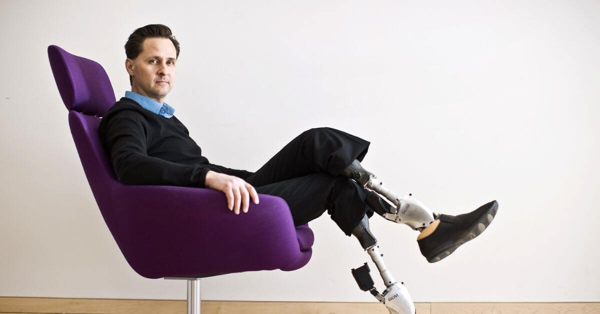 Epic Stories of 41 Famous Amputees: Triumph Against All Odds