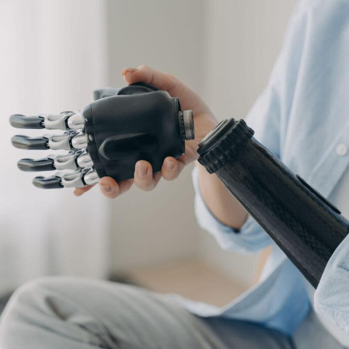 Child or Pediatric Prosthetics: An In-depth Guide for Parents - Is Brave