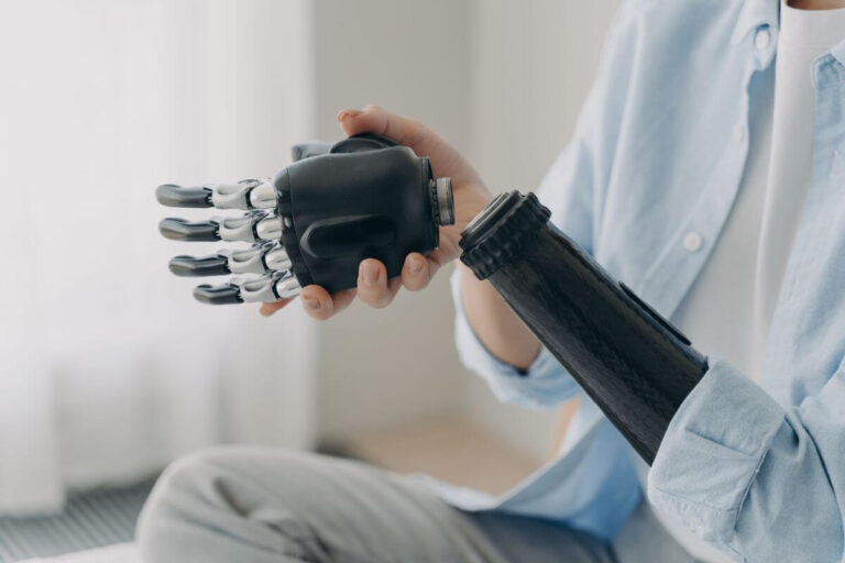 Prosthetic Hand Guide: Options & How to Choose the Best One - Is Brave