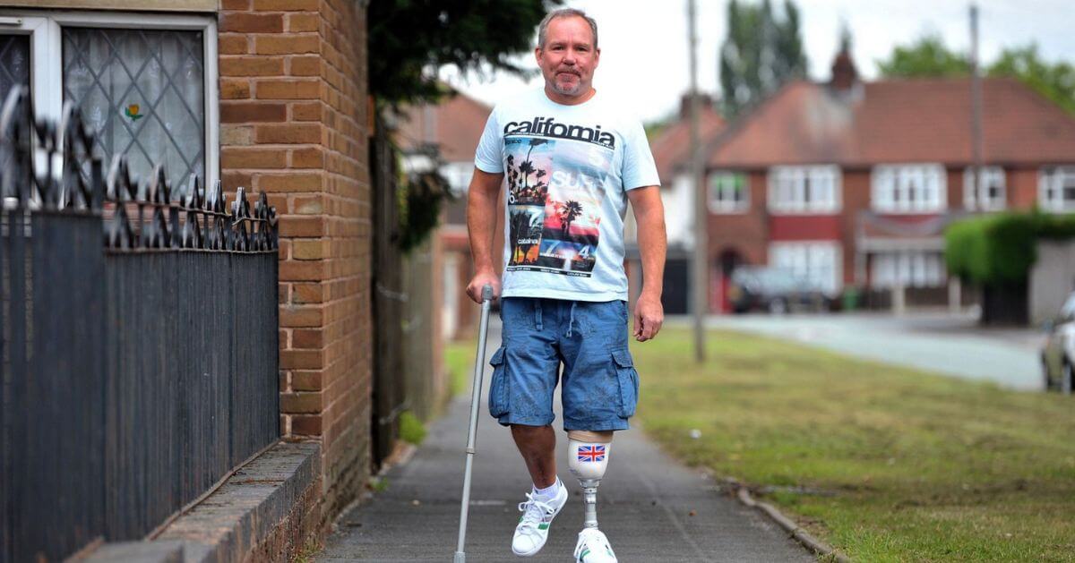 Epic Stories of 41 Famous Amputees: Triumph Against All Odds