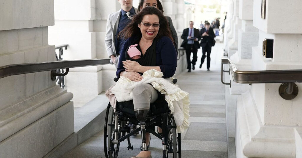 41 Famous Amputees and Their Stories: Athletes, Artists & More - Is Brave