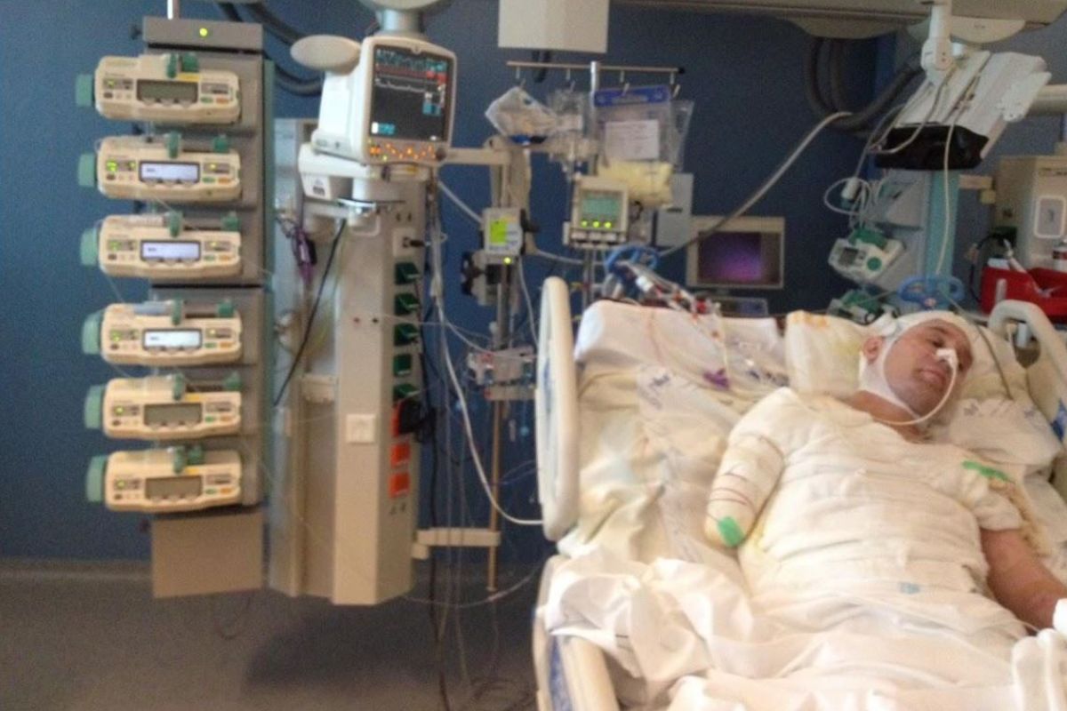 Becoming A Triple Amputee: The Fight No One Prepared Me For - Is Brave