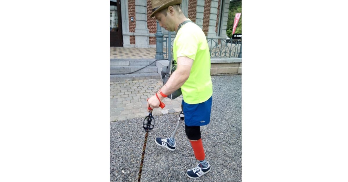 How to Move On After Amputation - Is Brave