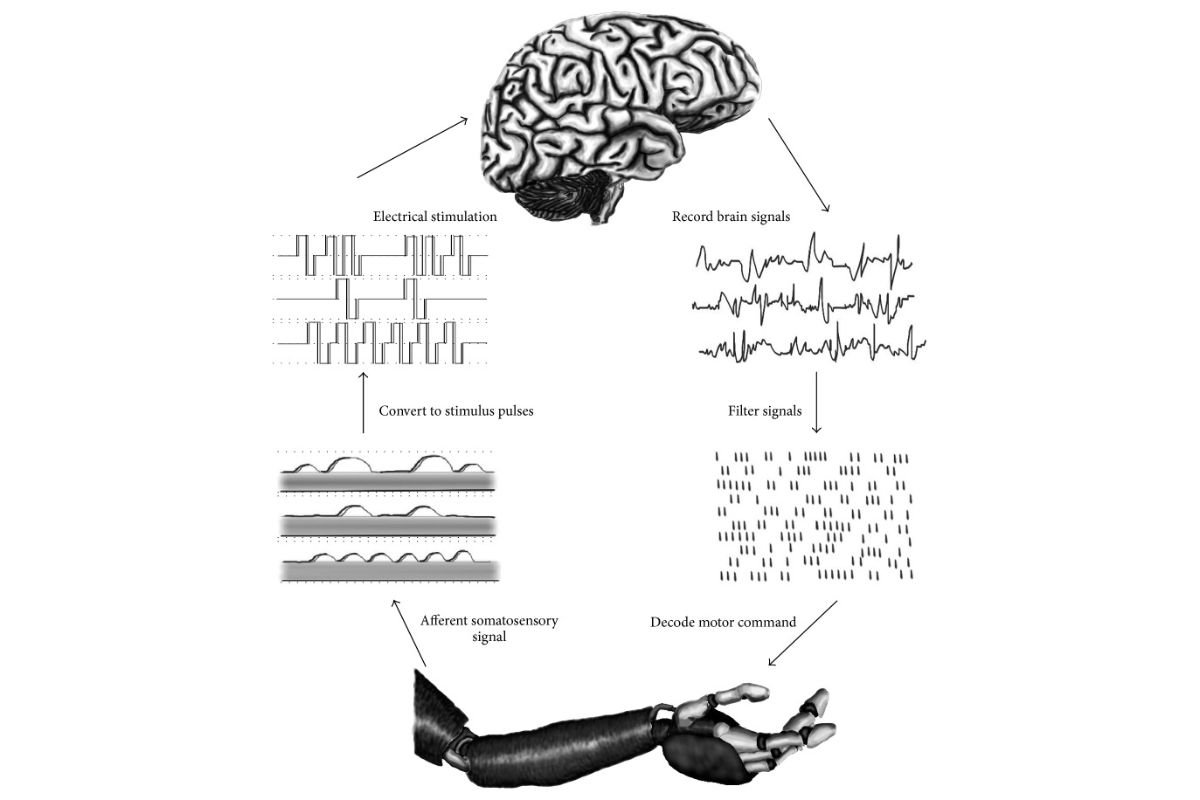 Brain-Controlled Prosthetics: Move Your Limbs With Your Mind - Is Brave